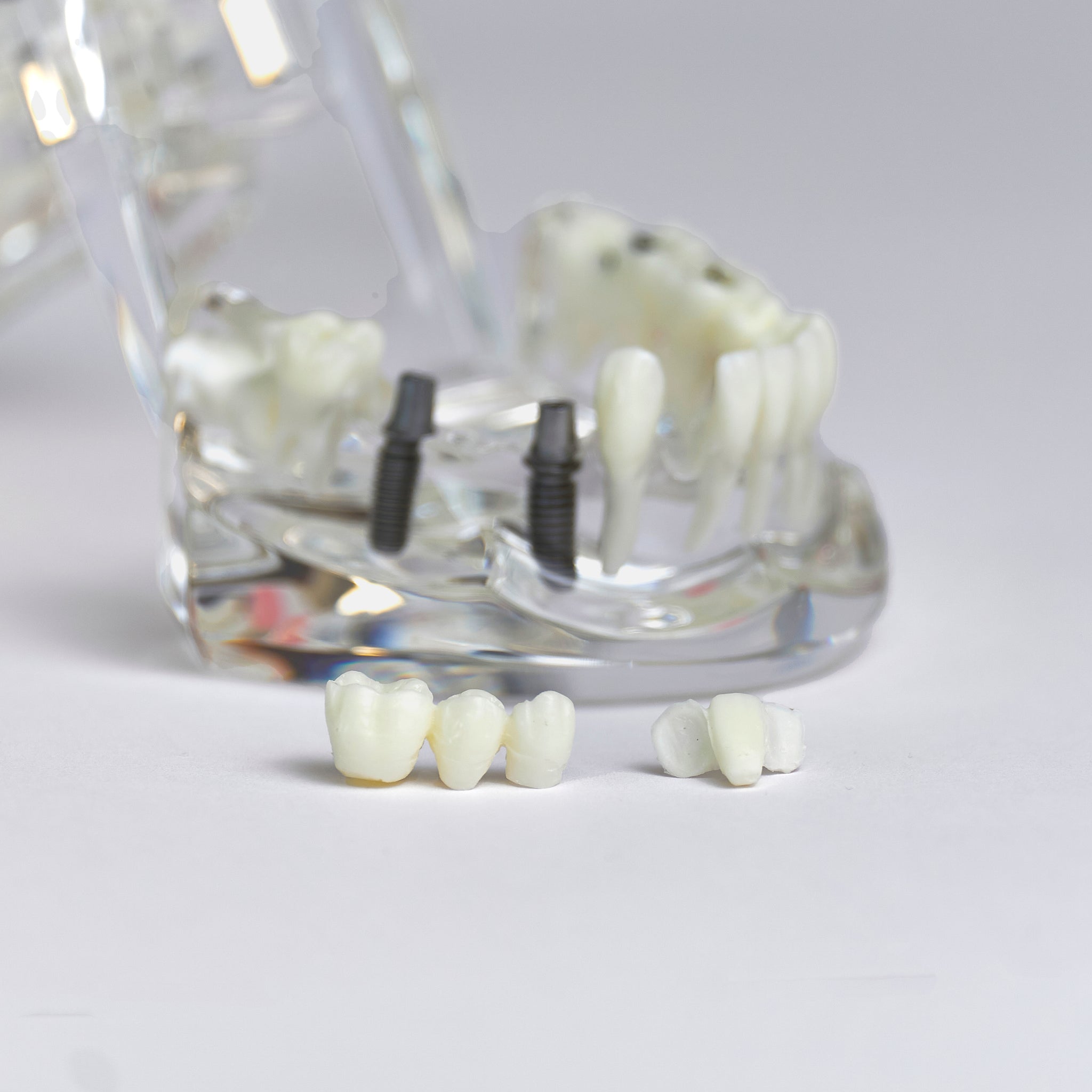Demonstration Models Dental Conditions S4s Dental