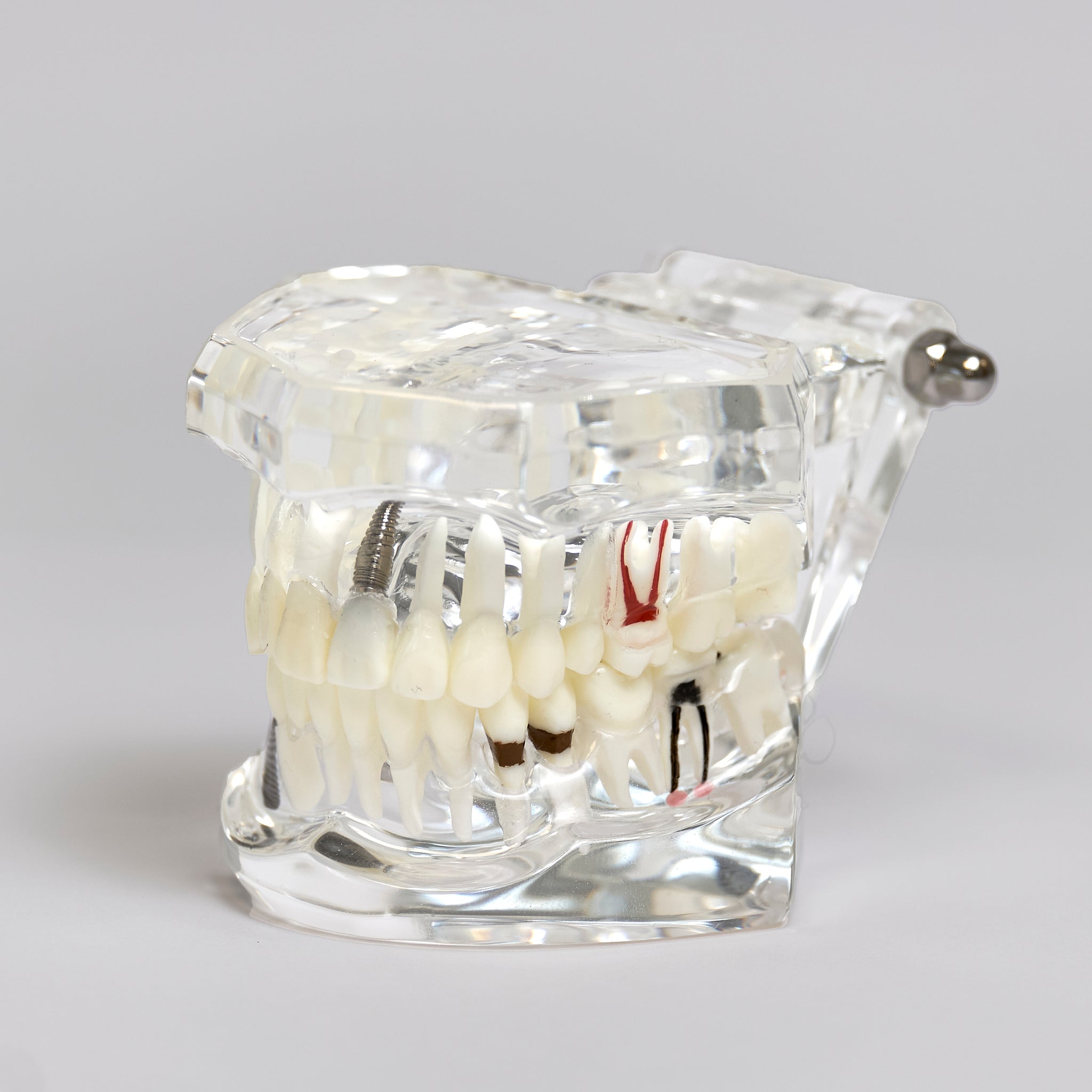Demonstration Models Dental Conditions S4s Dental