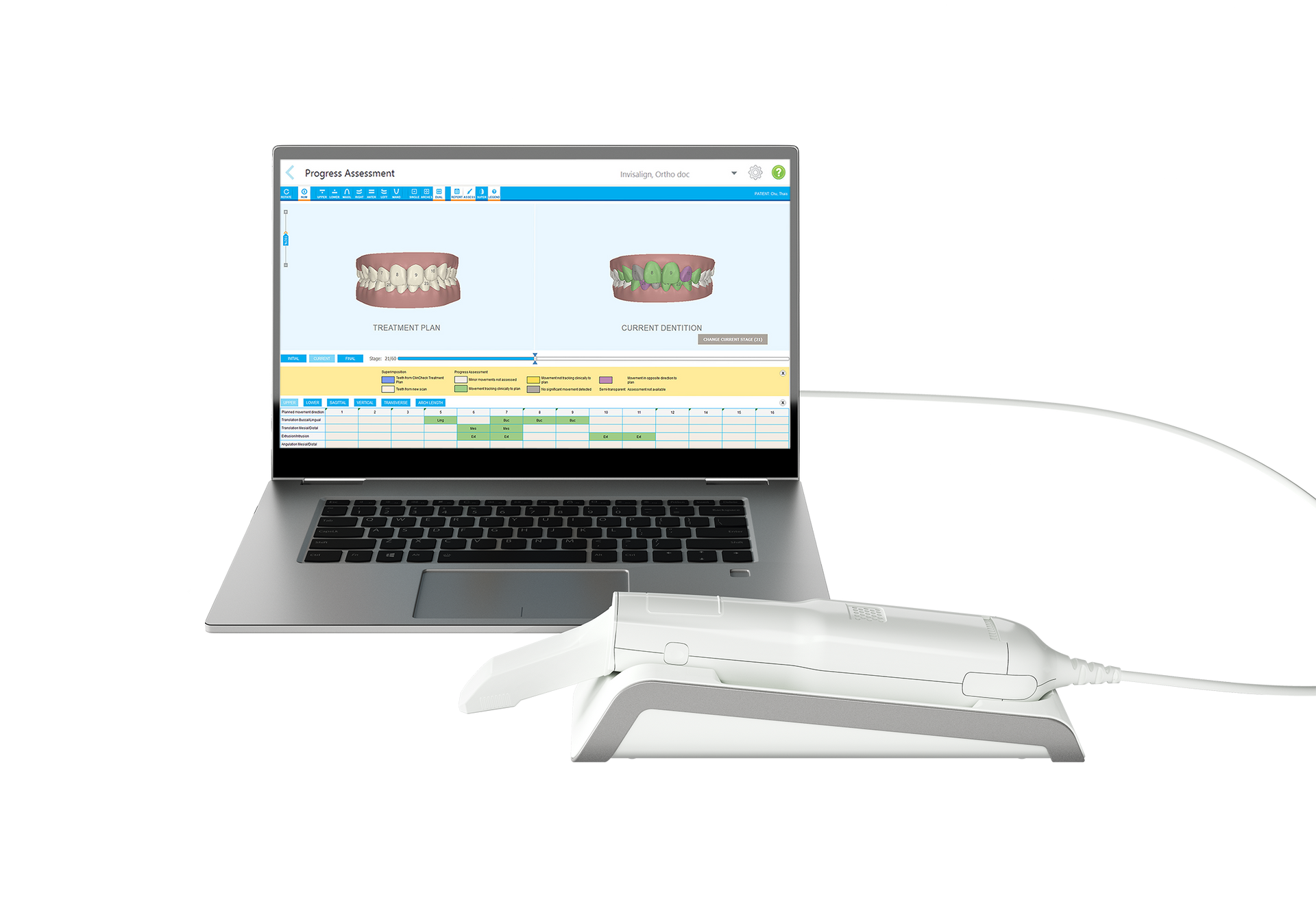 iTero Element Flex Digital Scanner – S4S Dental